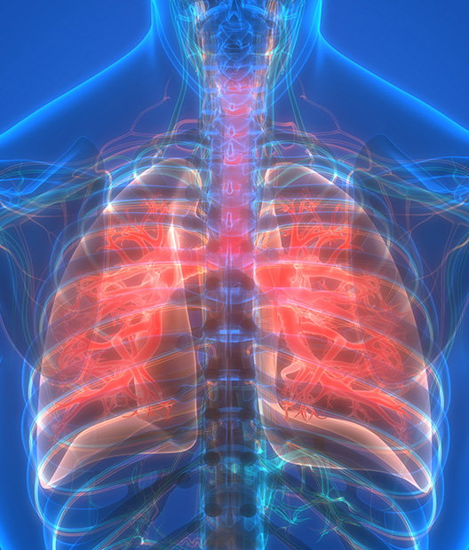 Flying with pulmonary fibrosis: navigating the skies with a lung condition